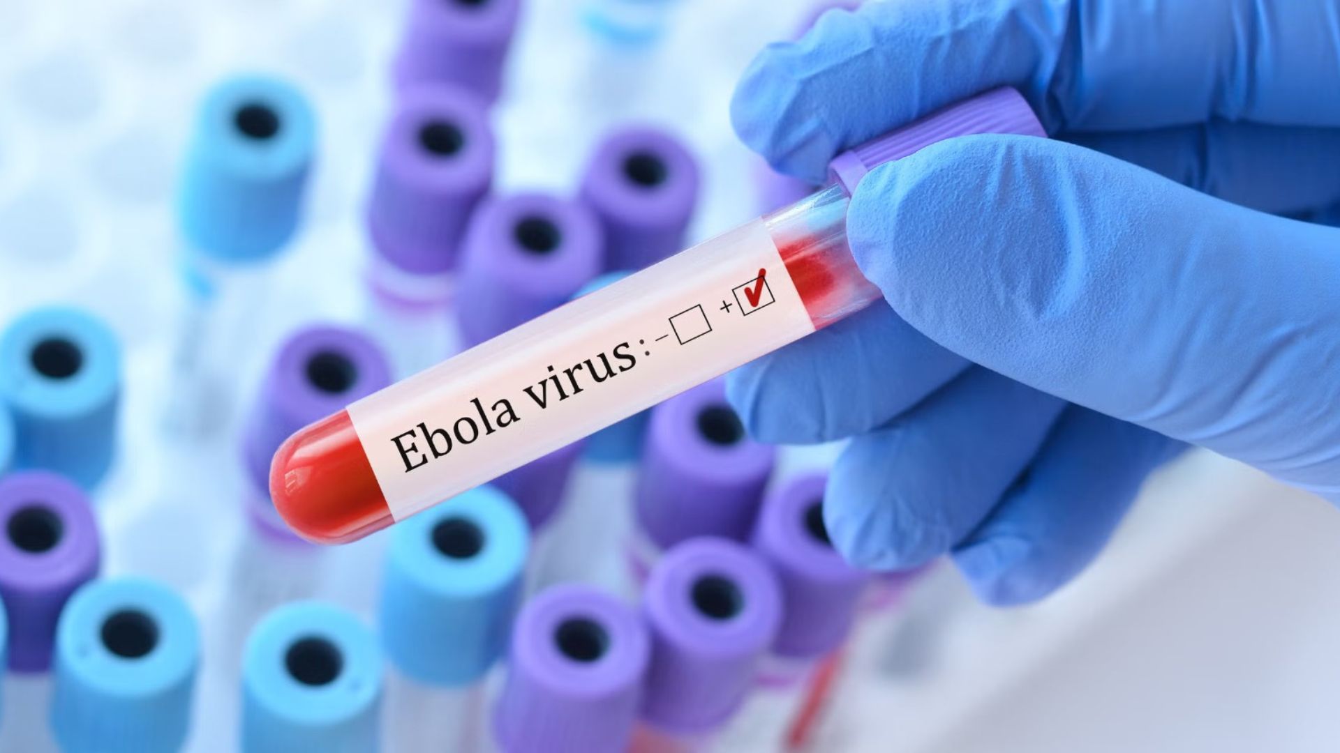 Ébola: ¿Cuáles son sus síntomas y cómo se contagia el virus? - Revista ...